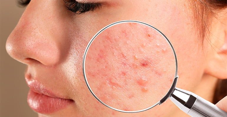 ¿Qué es dermatología?