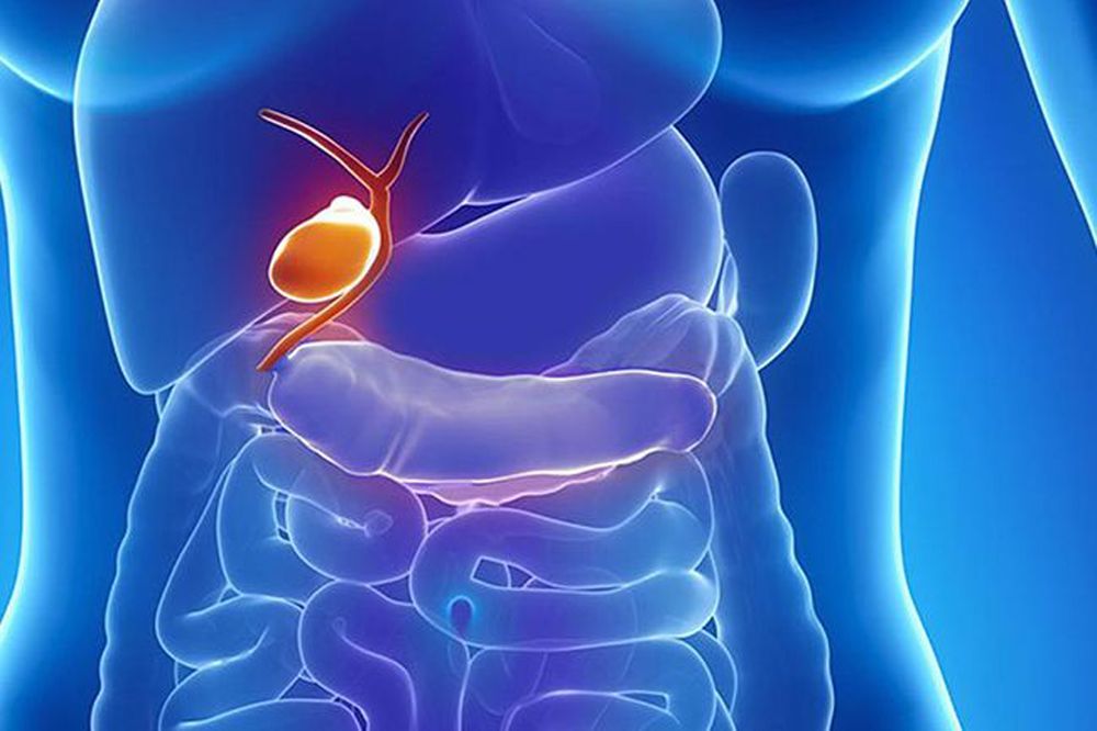 Diagnóstico y Tratamiento del Quiste del Colédoco Neonatal